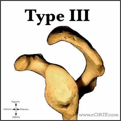 Subacromial Space Anatomy | eORIF